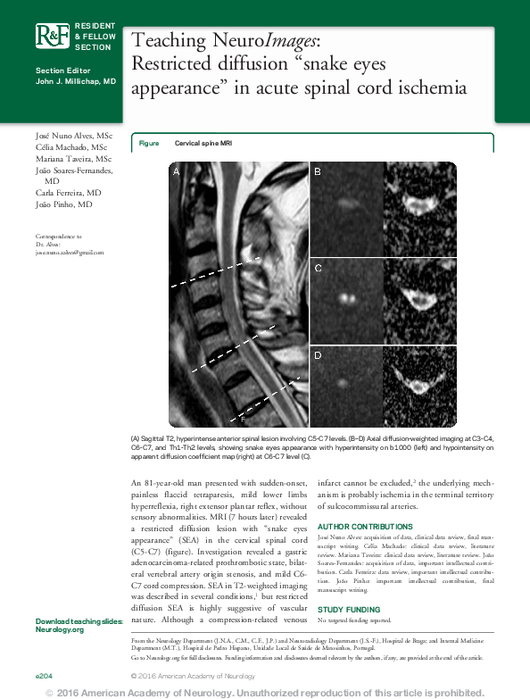 (PDF) Teaching NeuroImages: Restricted diffusion "snake eyes appearance ...