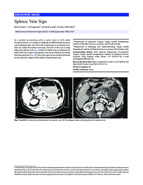 (PDF) Splenic Vein Sign