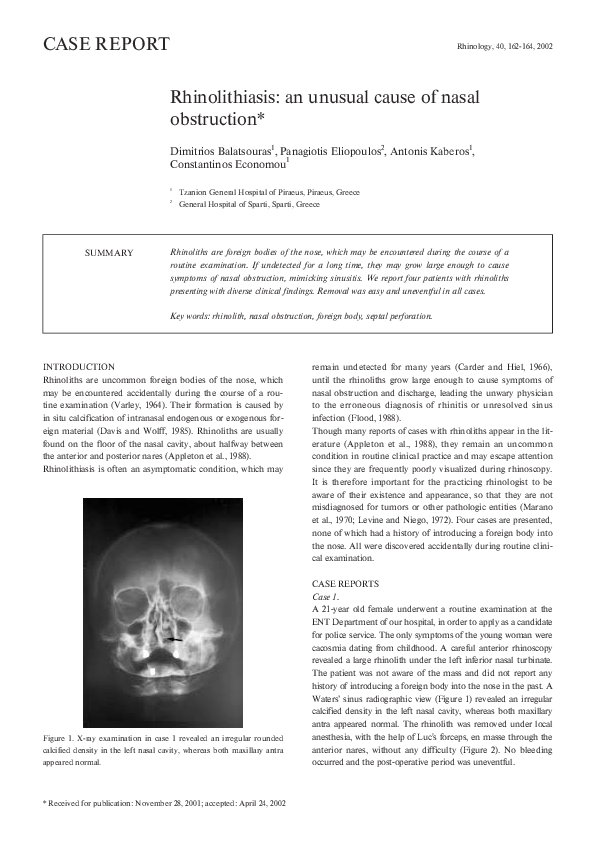 (PDF) Rhinolithiasis: an unusual cause of nasal obstruction