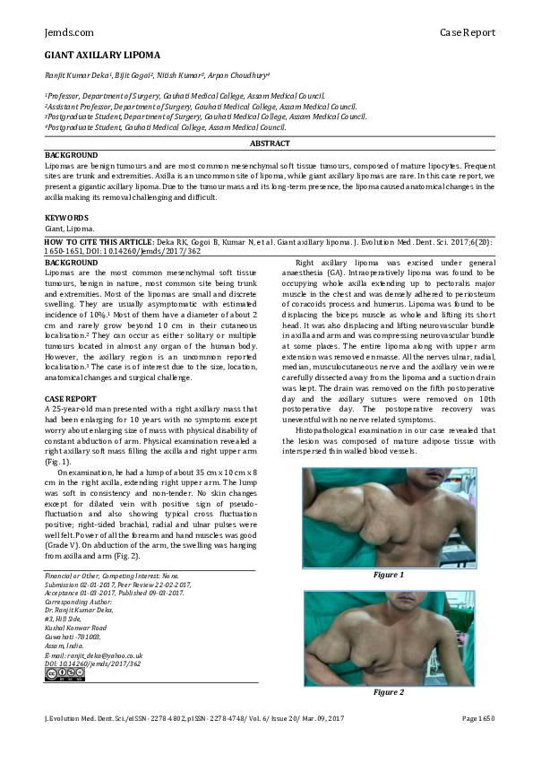 (PDF) Giant Axillary Lipoma