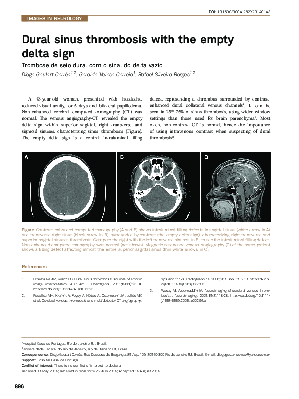 (PDF) Dural sinus thrombosis with the empty delta sign | Geraldo C O R ...