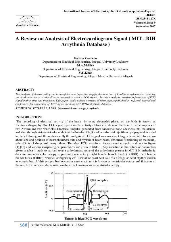 (PDF) 588 A Review on Analysis of Electrocardiogram Signal ( MIT-BIH ...