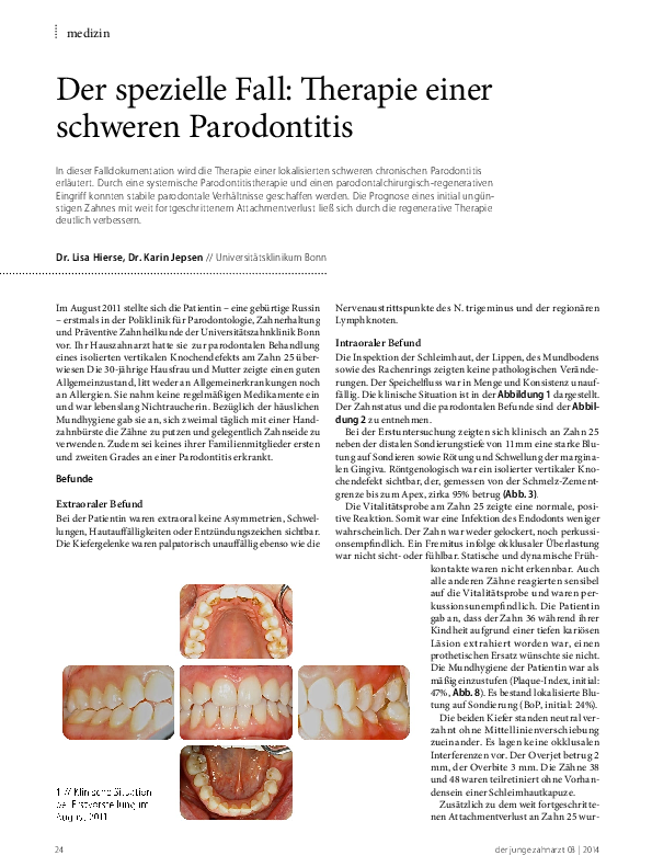 (PDF) Der spezielle Fall: Therapie einer schweren Parodontitis | Karin ...