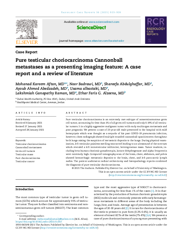 (PDF) Pure testicular choriocarcinoma Cannonball metastases as a ...