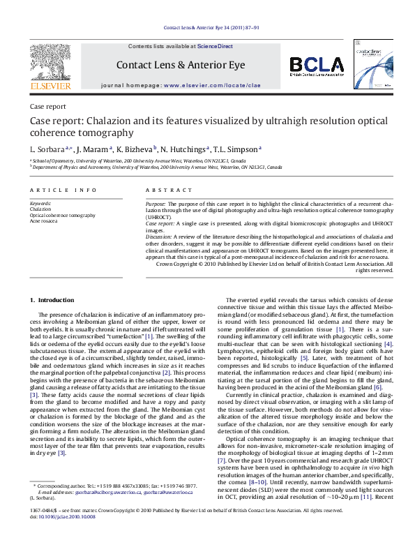 (PDF) Case report: Chalazion and its features visualized by ultrahigh ...