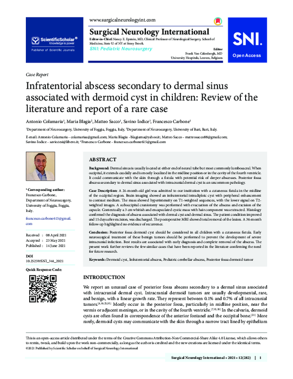 Pdf Nasofrontal Dermal Sinus With Intradiploic Epidermoid Cyst Case Report Mohamed Kilani
