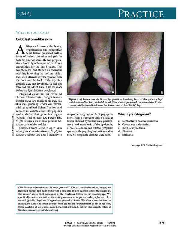 (PDF) Cobblestone-like skin