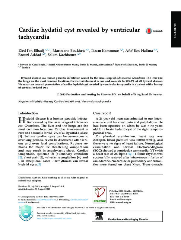 (PDF) Cardiac hydatid cyst revealed by ventricular tachycardia
