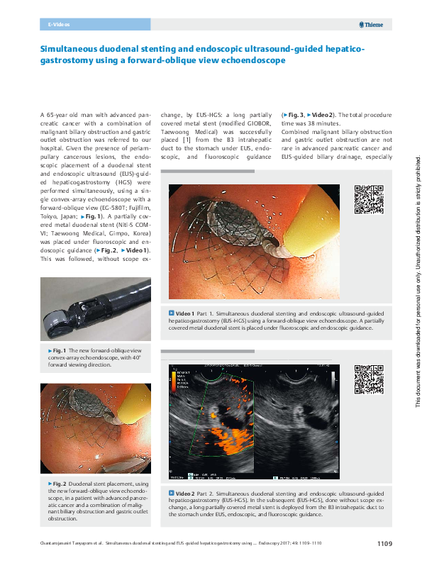 (PDF) Simultaneous EUS-HGS and Duodenal Stenting