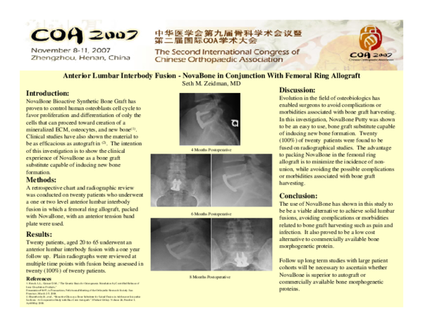 (PDF) Anterior Lumbar Interbody Fusion - NovaBone in Conjunction With ...