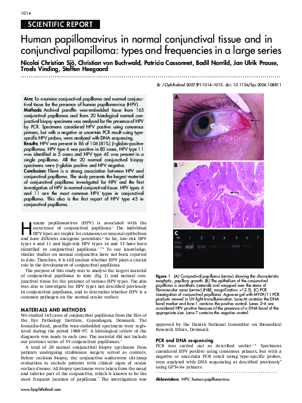 (PDF) Human papillomavirus in normal conjunctival tissue and in ...