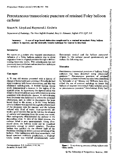 (PDF) Percutaneous transcolonic puncture of retained Foley balloon catheter
