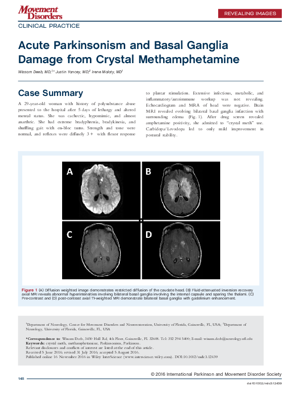 (PDF) Acute Parkinsonism and basal ganglia damage from crystal ...