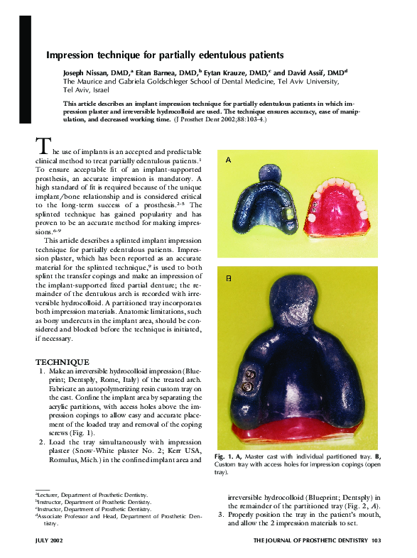 (PDF) Impression technique for partially edentulous patients