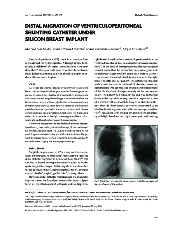 (PDF) Distal migration of ventriculoperitoneal shunting catheter under ...