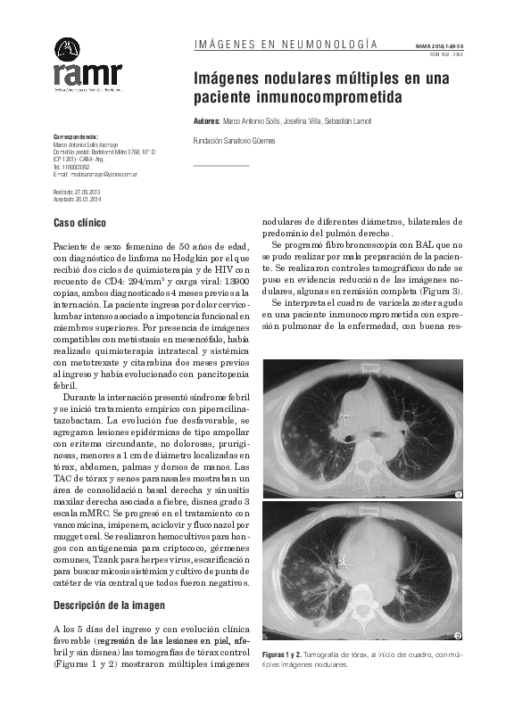 (PDF) Imágenes nodulares múltiples en una paciente inmunocomprometida
