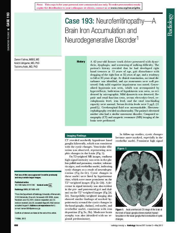 (PDF) Case 193: Neuroferritinopathy—A Brain Iron Accumulation and ...