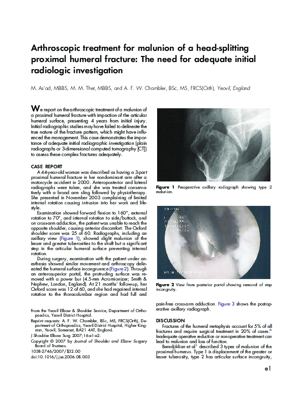 (PDF) Arthroscopic treatment for malunion of a head-splitting proximal ...