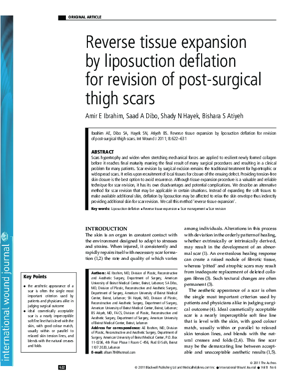 (PDF) Reverse tissue expansion by liposuction deflation for revision of ...