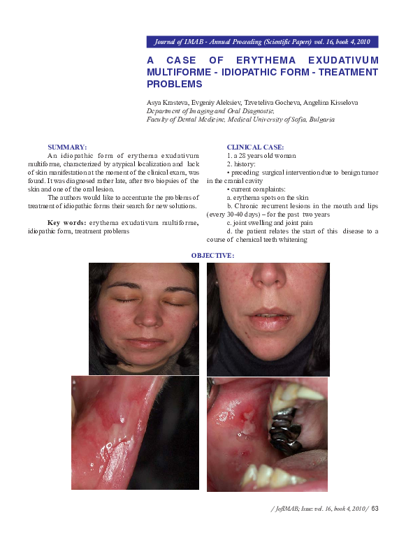 (PDF) A Case of Erythema Exudativum Multiforme - Idiopathic Form ...