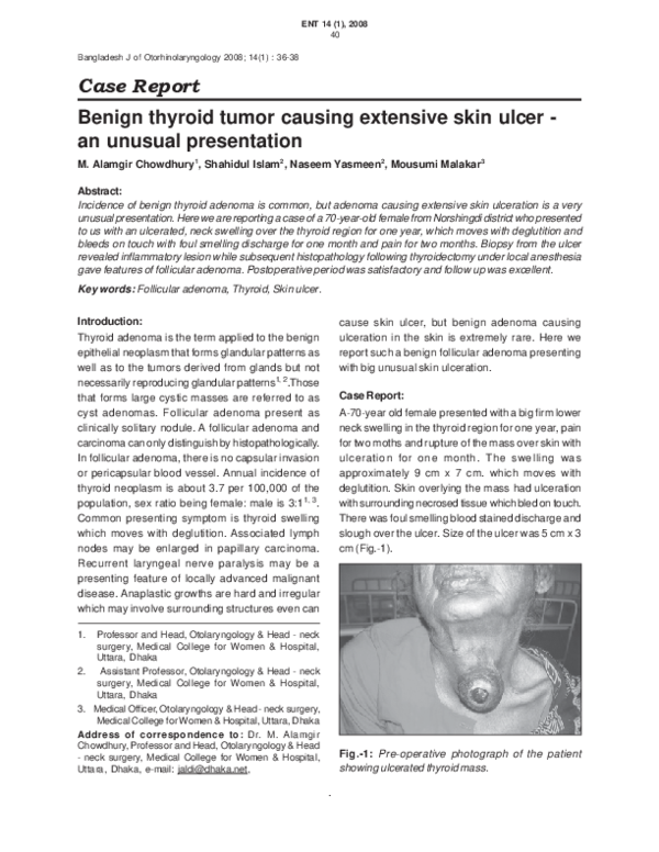 (PDF) Benign thyroid tumor causing extensive skin ulcer - an unusual ...