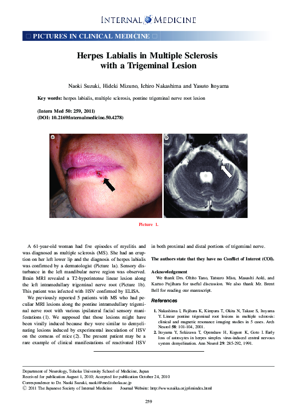 (PDF) Herpes Labialis in Multiple Sclerosis with a Trigeminal Lesion