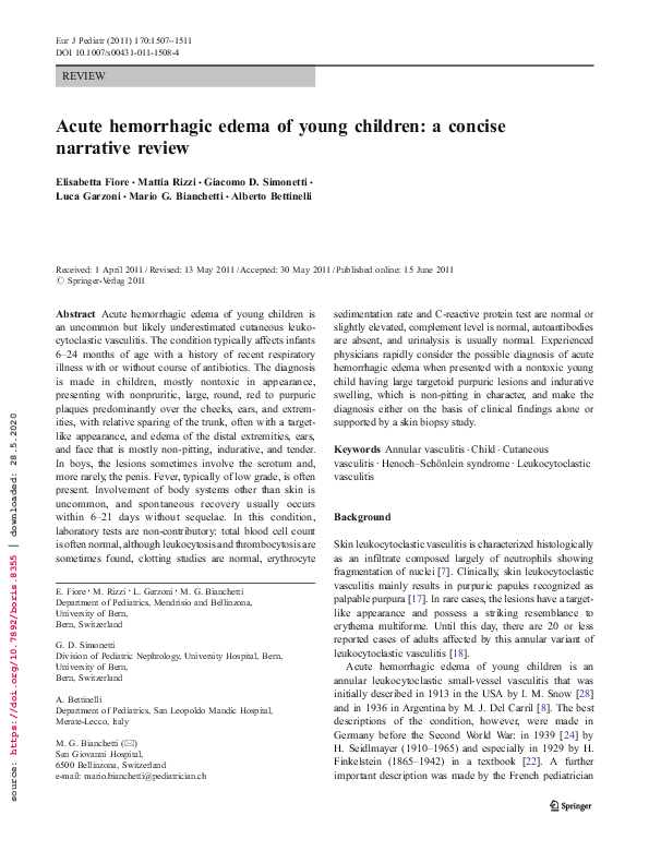 Köbner And Pastia Signs In Acute Hemorrhagic Edema Of Young – NQETJ