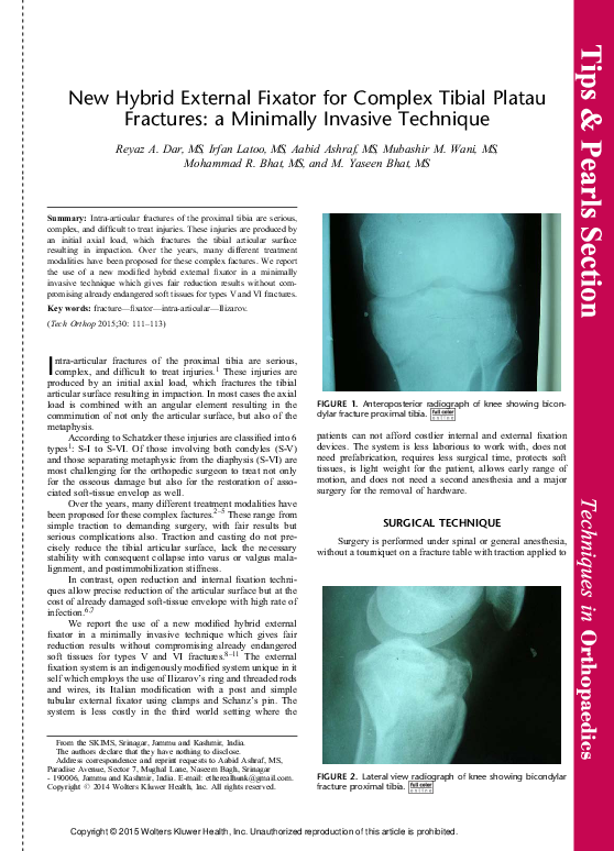 (PDF) New Hybrid External Fixator for Complex Tibial Platau Fractures