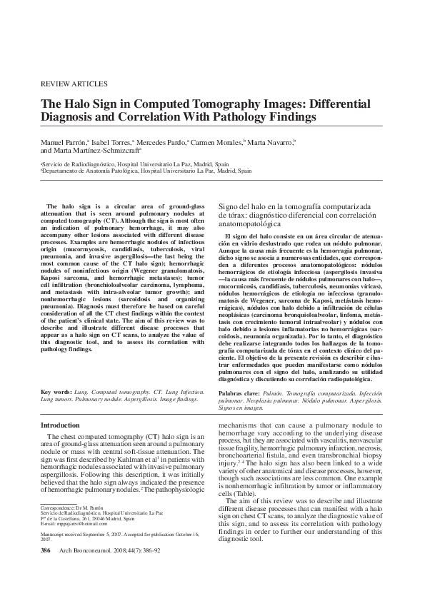 (PDF) The Halo Sign in Computed Tomography Images: Differential ...