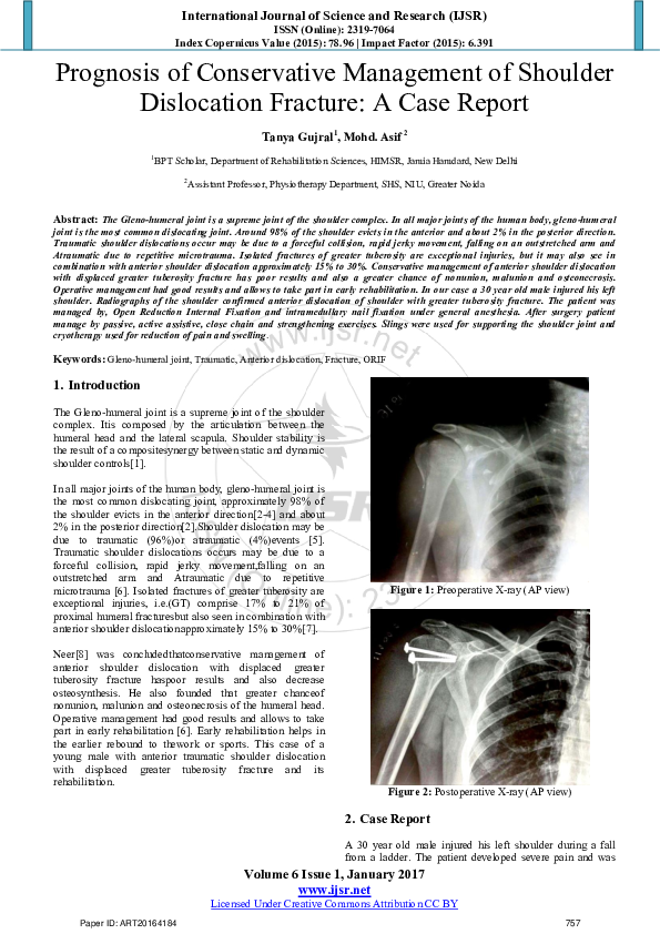 Anterior Shoulder Dislocation Mechanism Of Injury