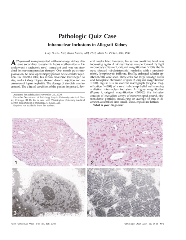(PDF) Pathologic Quiz Case: Intranuclear Inclusions in Allograft Kidney ...