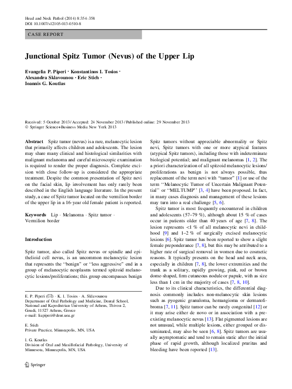 (PDF) Junctional Spitz Tumor (Nevus) of the Upper Lip | Konstantinos ...