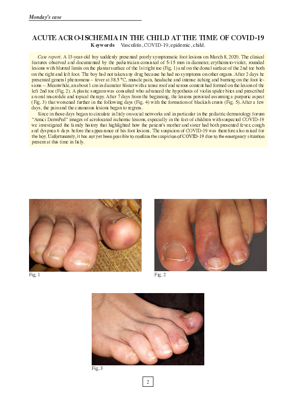 (PDF) SARS-CoV-2: It is Severe and Acute, but is it Only a Respiratory ...