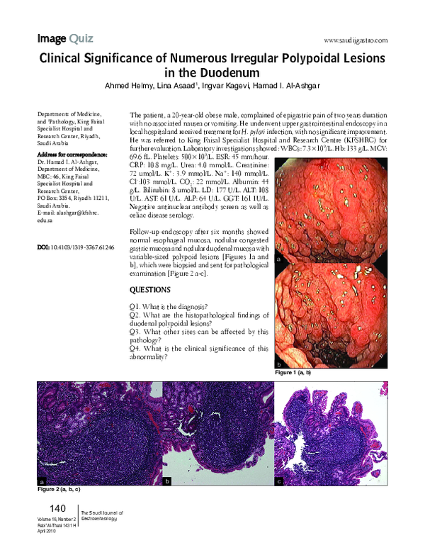 (PDF) Clinical significance of numerous irregular polypoidal lesions in ...