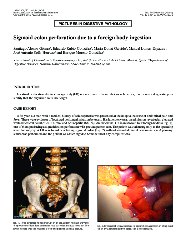 (PDF) Sigmoid colon perforation due to a foreign body ingestion