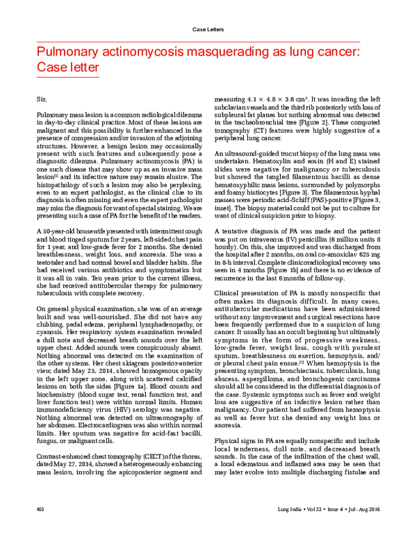 (PDF) Pulmonary actinomycosis masquerading as lung cancer: Case letter