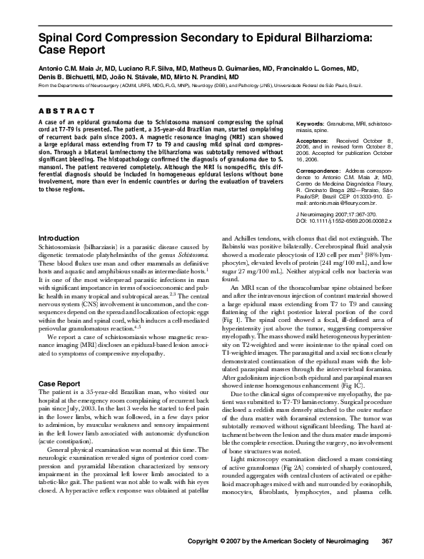 (PDF) Spinal Cord Compression Secondary to Epidural Bilharzioma: Case Report
