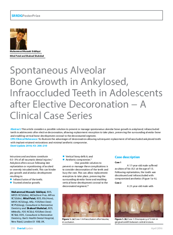 (PDF) Spontaneous Alveolar Bone Growth in Ankylosed, Infraoccluded ...