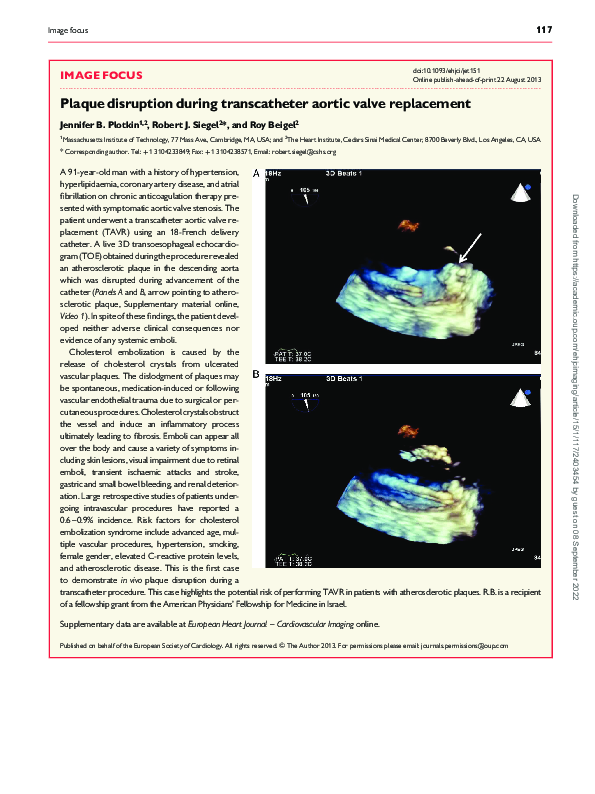 (PDF) Plaque disruption during transcatheter aortic valve replacement ...