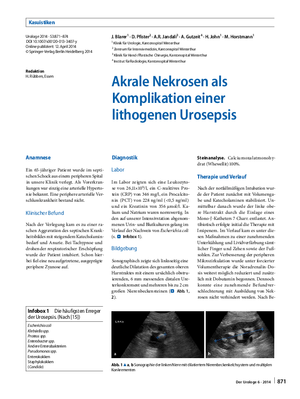 (PDF) Akrale Nekrosen als Komplikation einer lithogenen Urosepsis