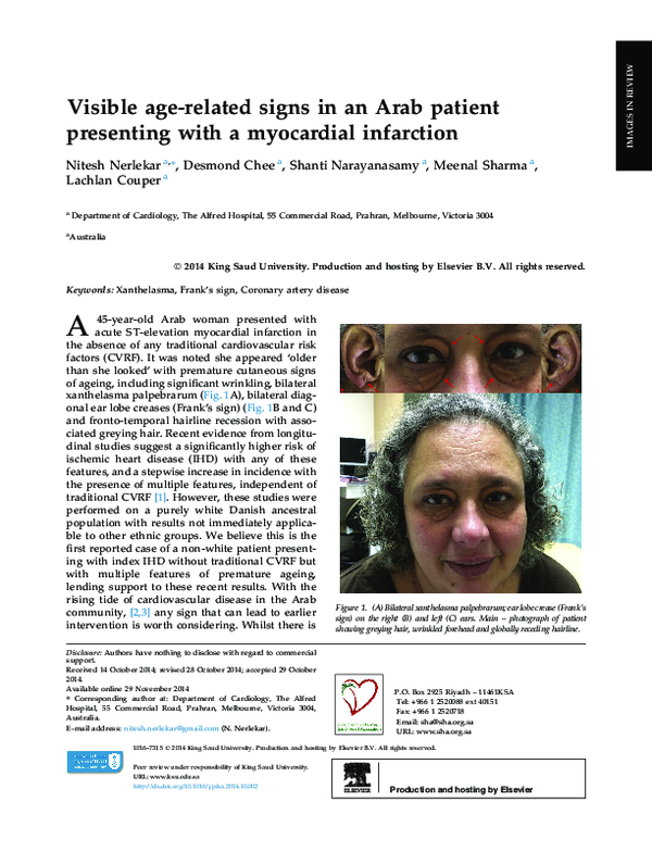 (PDF) Visible age-related signs in an Arab patient presenting with a ...