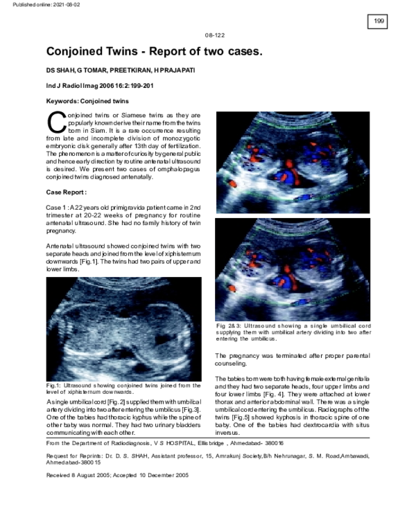 (PDF) Conjoined twins - Report of two cases