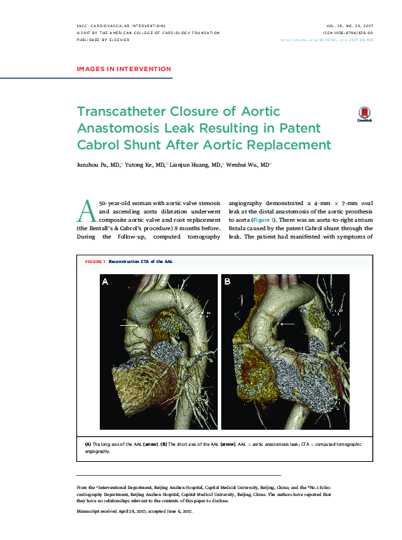(PDF) Transcatheter Closure of Aortic Anastomosis Leak Resulting in ...