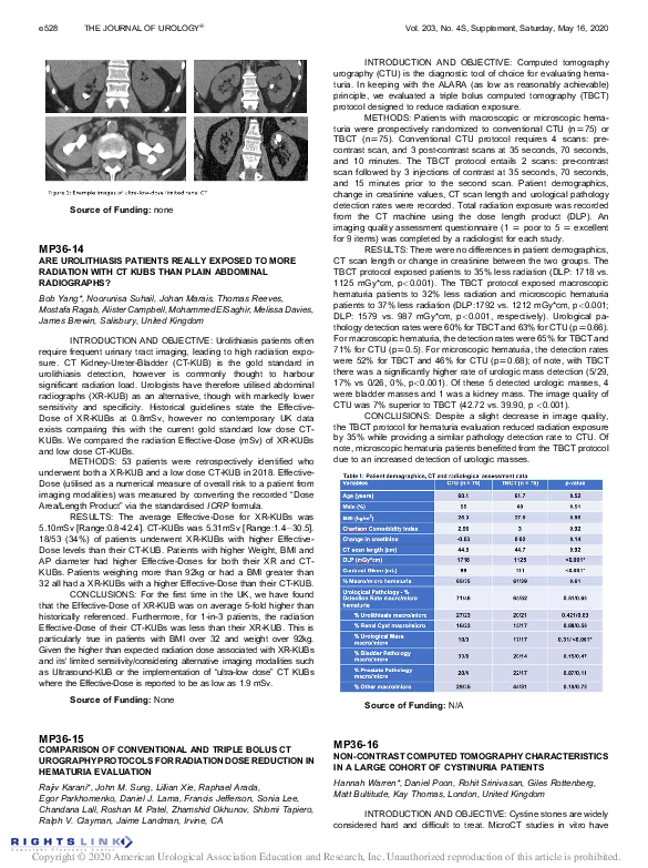 (PDF) MP36-14 ARE Urolithiasis Patients Really Exposed to More Radiation with CT Kubs Than Plain ...