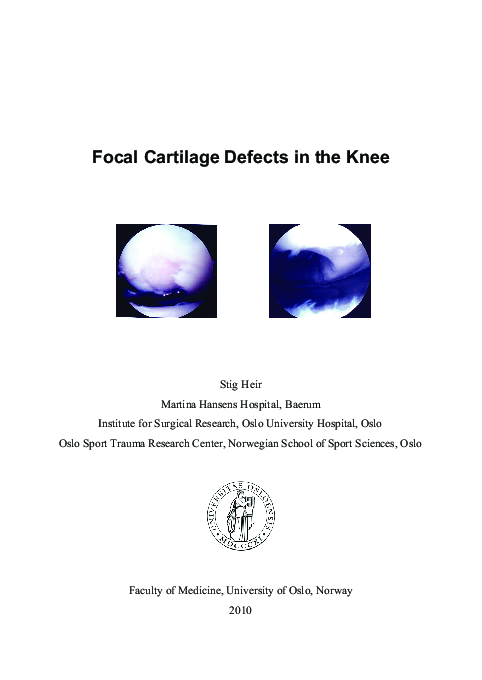 (PDF) Focal Cartilage Defects in the Knee Impair Quality of Life as ...