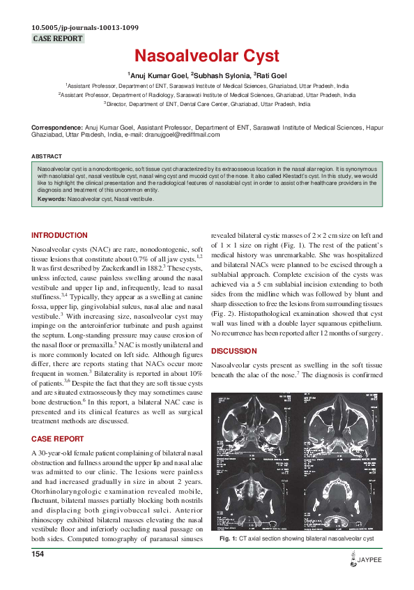Pdf Nasoalveolar Cyst Subhash Sylonia