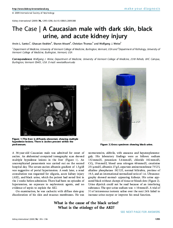 (PDF) The Case ∣ A Caucasian male with dark skin, black urine, and ...
