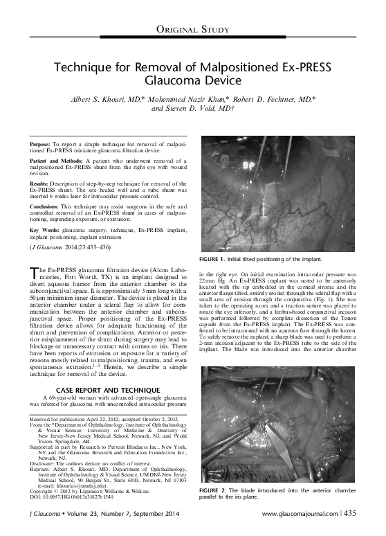 (PDF) Technique for Removal of Malpositioned Ex-PRESS Glaucoma Device ...