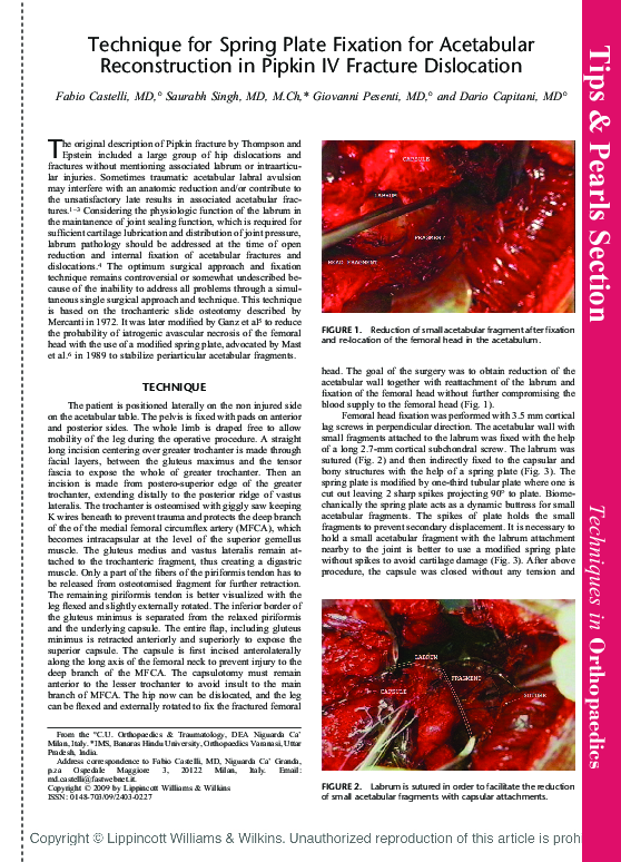 (PDF) Technique for Spring Plate Fixation for Acetabular Reconstruction ...