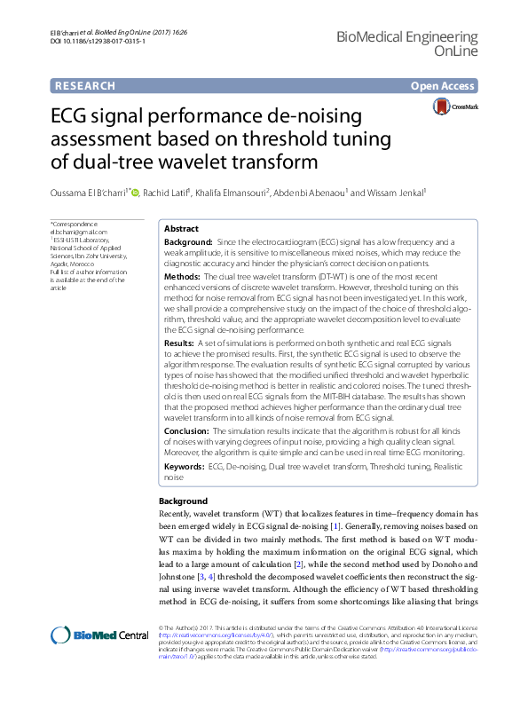 (PDF) ECG signal performance de-noising assessment based on threshold tuning of dual-tree ...